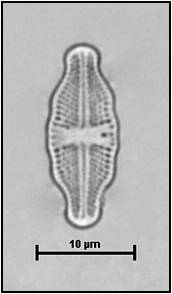 Luticola nivalis (Ehrenberg) Mann in Round, Crawford & Mann, 1990 ...
